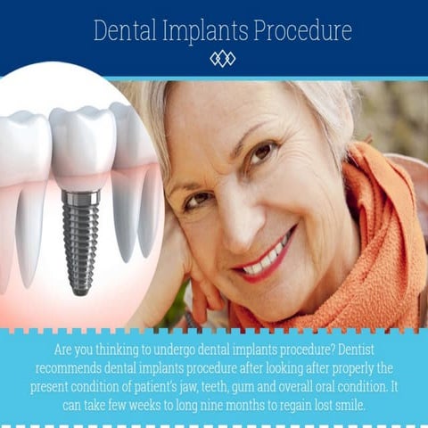 Dental Implants: A Modern Solution for Missing Teeth | PPTX