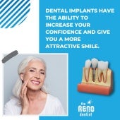 Enhance Your Smile With Dental Implants In Reno, NV | PDF