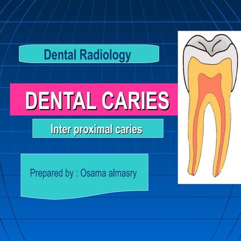 Dental interproximal caries | PPT