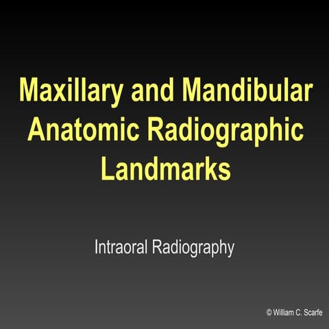Dental Maxillary and Mandibular Anatomic Radiographic Landmarks.ppt