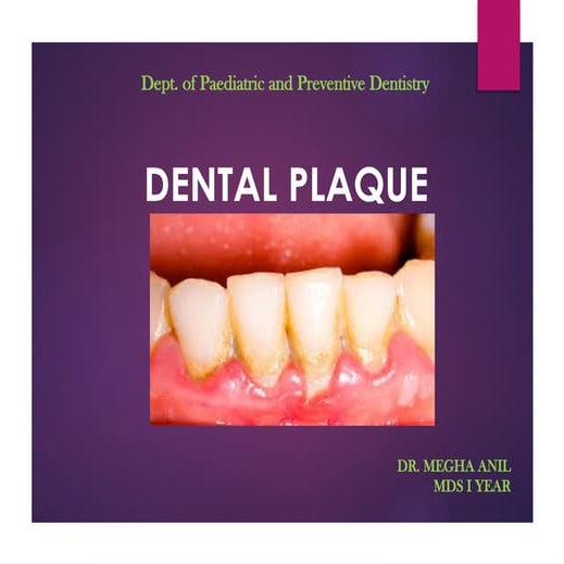 Plaque | PPTX