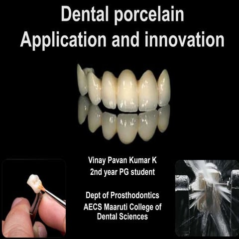 Dental Ceramics : Innovation and Application | PPTX