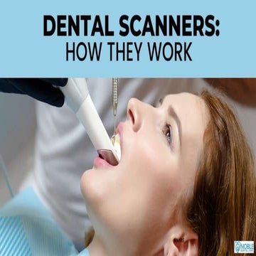 Dental Scanners How They Work | PPTX