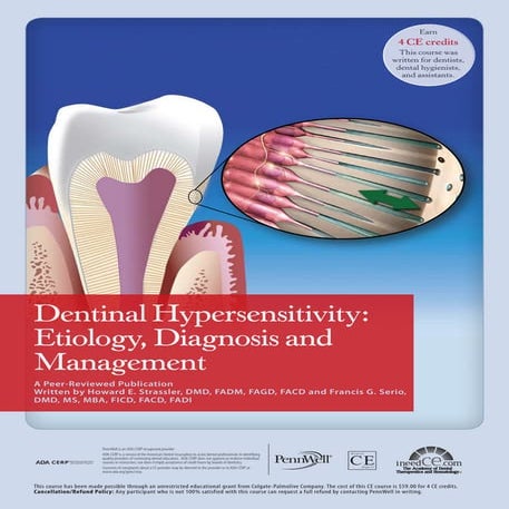 Dentinalhypersensitivity | PDF