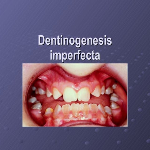 Dentinogenesis imperfecta | PPT