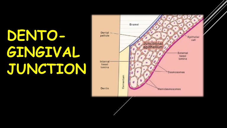 Dento gingival junction