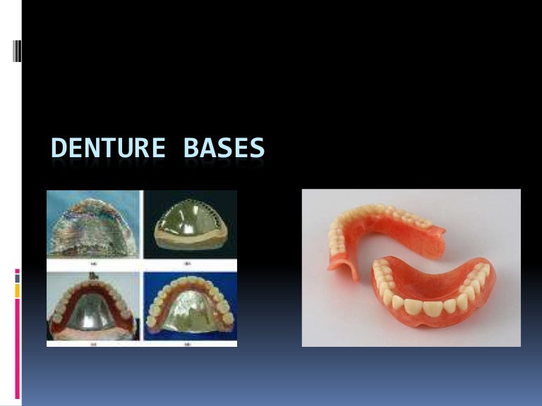 Denture bases