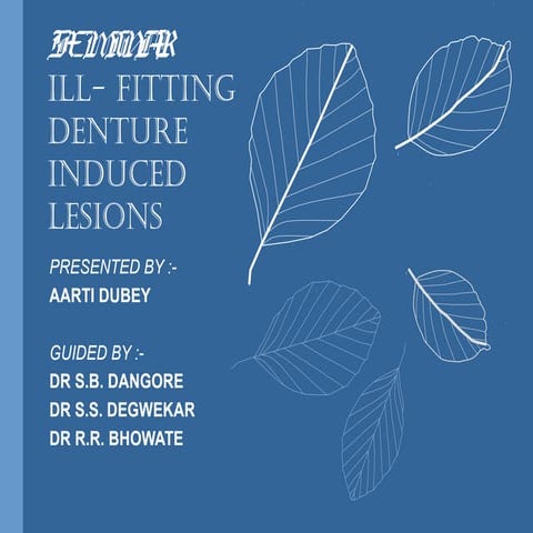 Denture induced lesions- Aarti Dubey | PPT