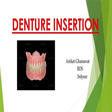 Denture Insertion (1).pdf.pptx vvvvvvvvv | PPTX