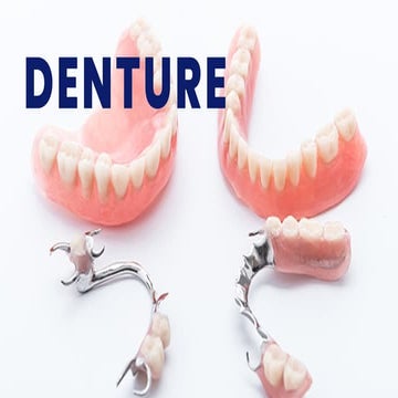 B- Retention of Removable Partial Dentures | PPT