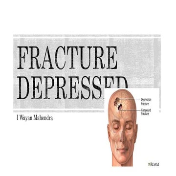 Depressed Fracture of the skull in trauma.pptx