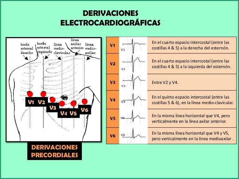 Derivaciones electrocardiograficas