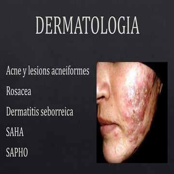Acne, rosacea,dermatitis seborreica, SAHA y SAPHO | PPTX