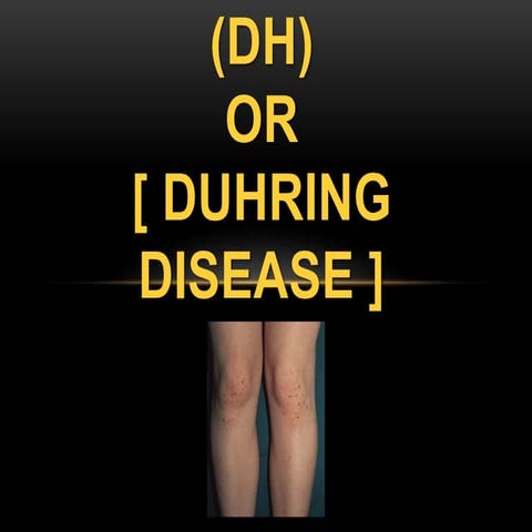 Dermatitis herpetiformis (dh) | PPTX