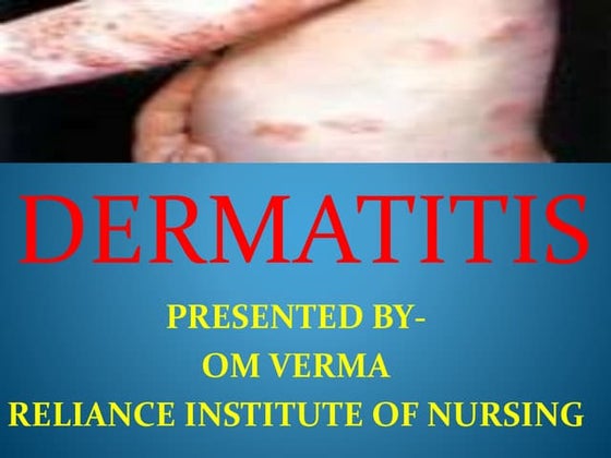Dermatitis | PPT