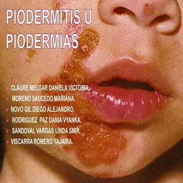 PIODERMITIS PIODERMIAS DERMATOLOGIA | PPTX