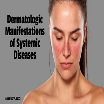 Dermatologic Manifestations of Systemic Diseases.pdf
