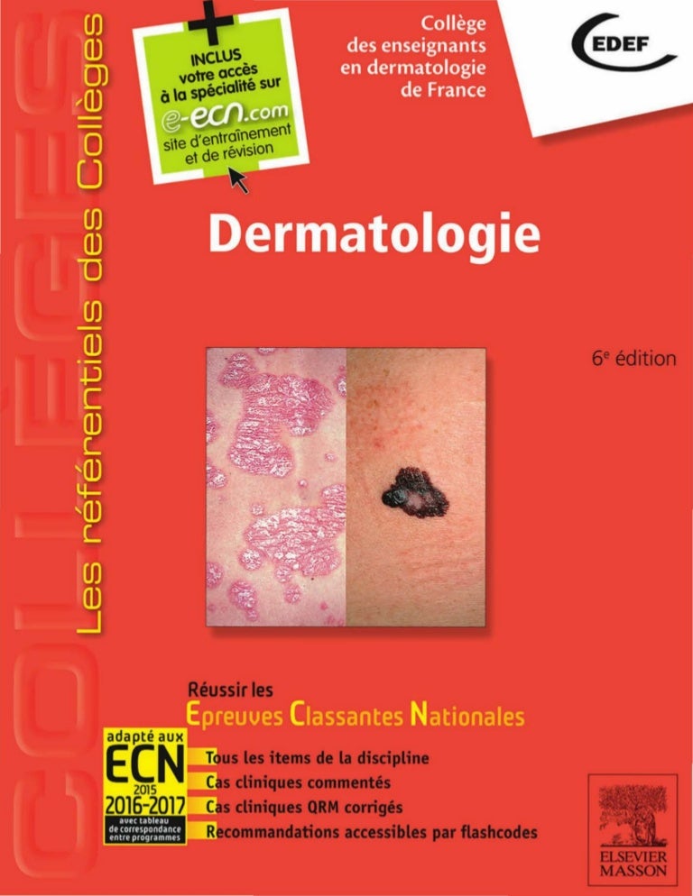 Item 232 – Dermatoses faciales : dermatite séborrhéique - Santé Et ...