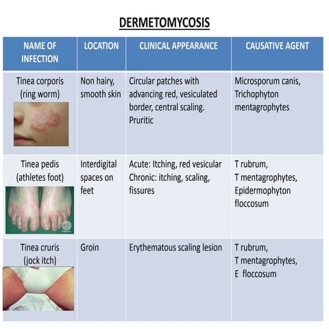 Dermetomycosis & measles | PDF