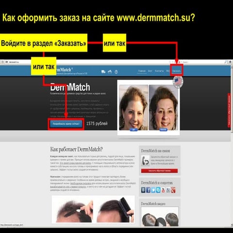 Как купить DermMatch в России | PPT