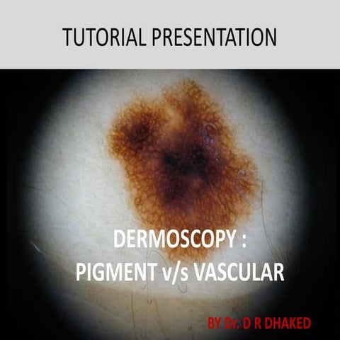 Dermoscopy pigment vs vascular | PPTX