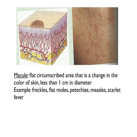 Skin lesions | PPT