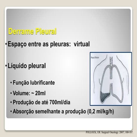 Empiema pleural.pptx