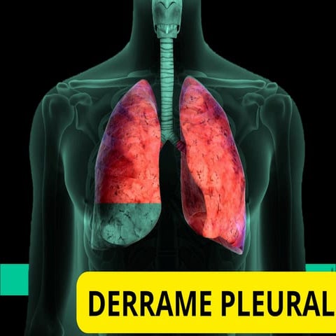 DERRAME PLEURAL, clinica, diagnostico .pptx