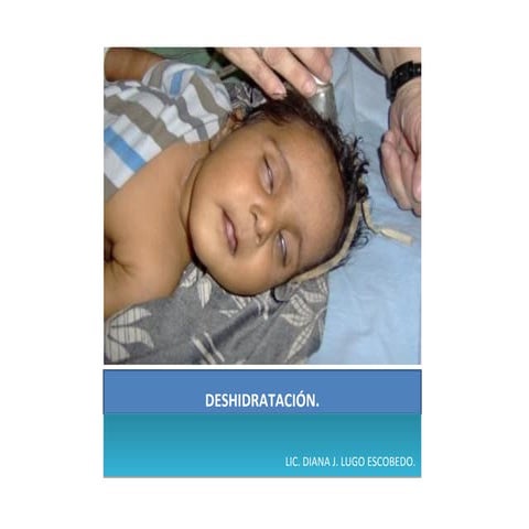 Deshidratación | PPT