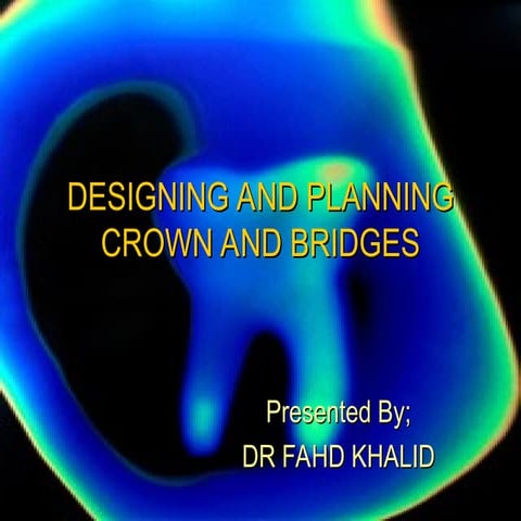 1. fixed partial denture finals1 | PPT