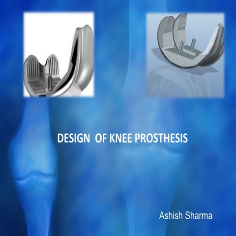 Design Of Knee Prosthesis and Analysis-Ashish Sharma | PDF