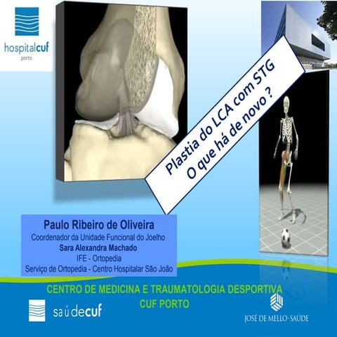 What´s new in Acl reconstrution | PPTX