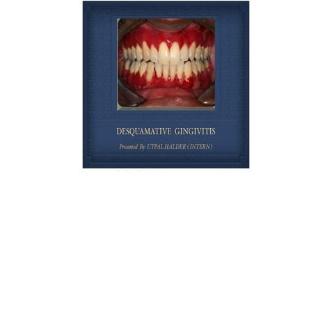 Desquamative gingivitis | PDF