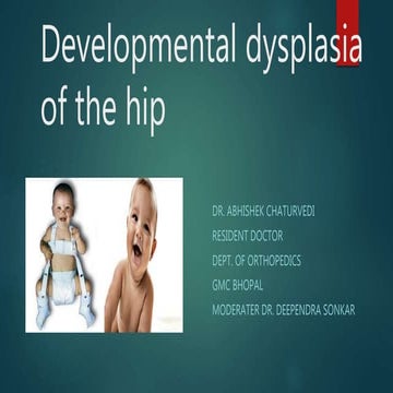 Developmental dysplasia of the hip | PPTX