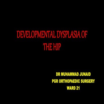 Splints in DDH | PDF