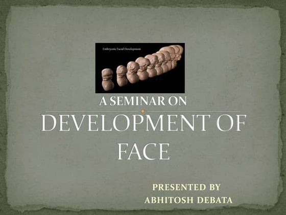 Developmental Disturbances of The Face | PPT