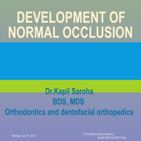 ANGLE'S CLASSIFICATION OF MALOCCLUSION | PPTX