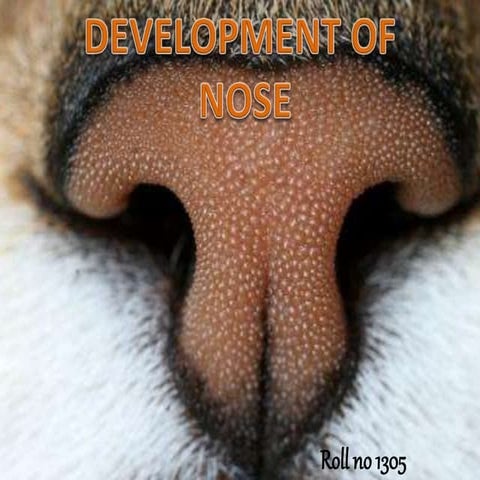 Development of nose by av sharma | PPTX