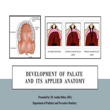 DEVELOPMENT OF PALATE AND ITS APPLIED ANATOMY.pptx