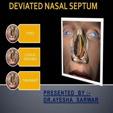 Deviated nasal septum | PPTX
