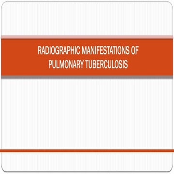 Imaging in tuberculosis by department of radiology | PPTX