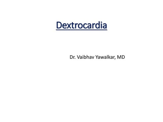 Dextrocardia | PPTX