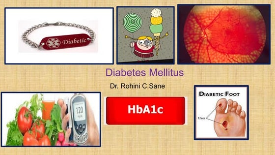 LAB DIAGNOSIS N INVESTIGATION OF DIABETES MELLITUS. | PPT