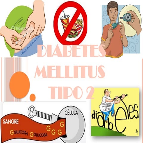 Comprehensive Overview of Type 2 Diabetes Mellitus: Pathophysiology ...