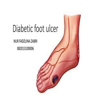 Diabetic Foot Care | PPTX