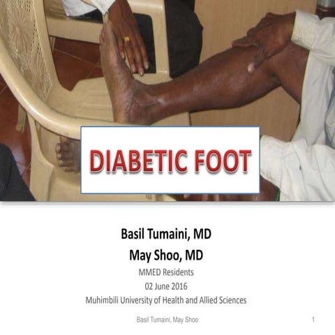 Diabetic foot by Dr. Basil Tumaini and Dr. May Shoo | PPTX
