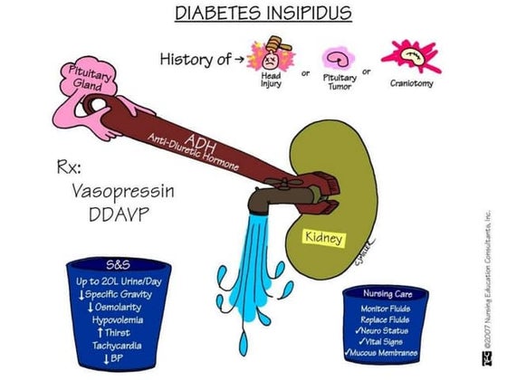 Diabetes insipidus | PPTX