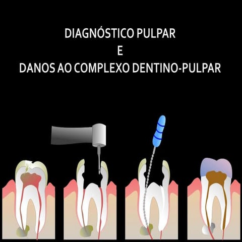 Topografia_e_anatomia_da_cavidade_pulpar.pdf
