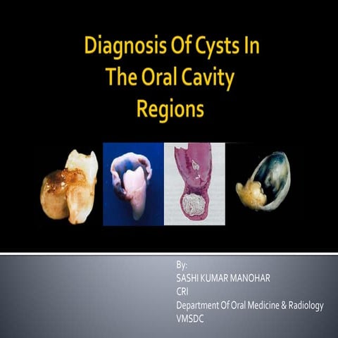 Diagnosis of cysts in oral cavity | PPTX
