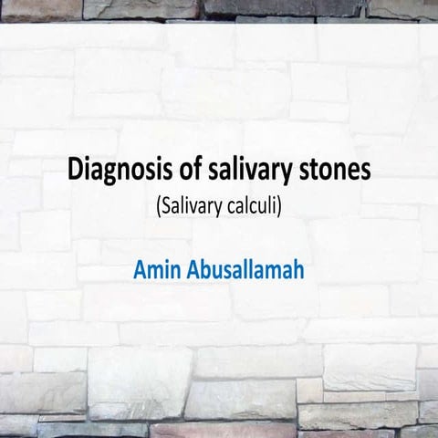 Diagnosis of salivary stones | PPTX